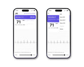 ECG/EKG sensor and mobile application – Movesense